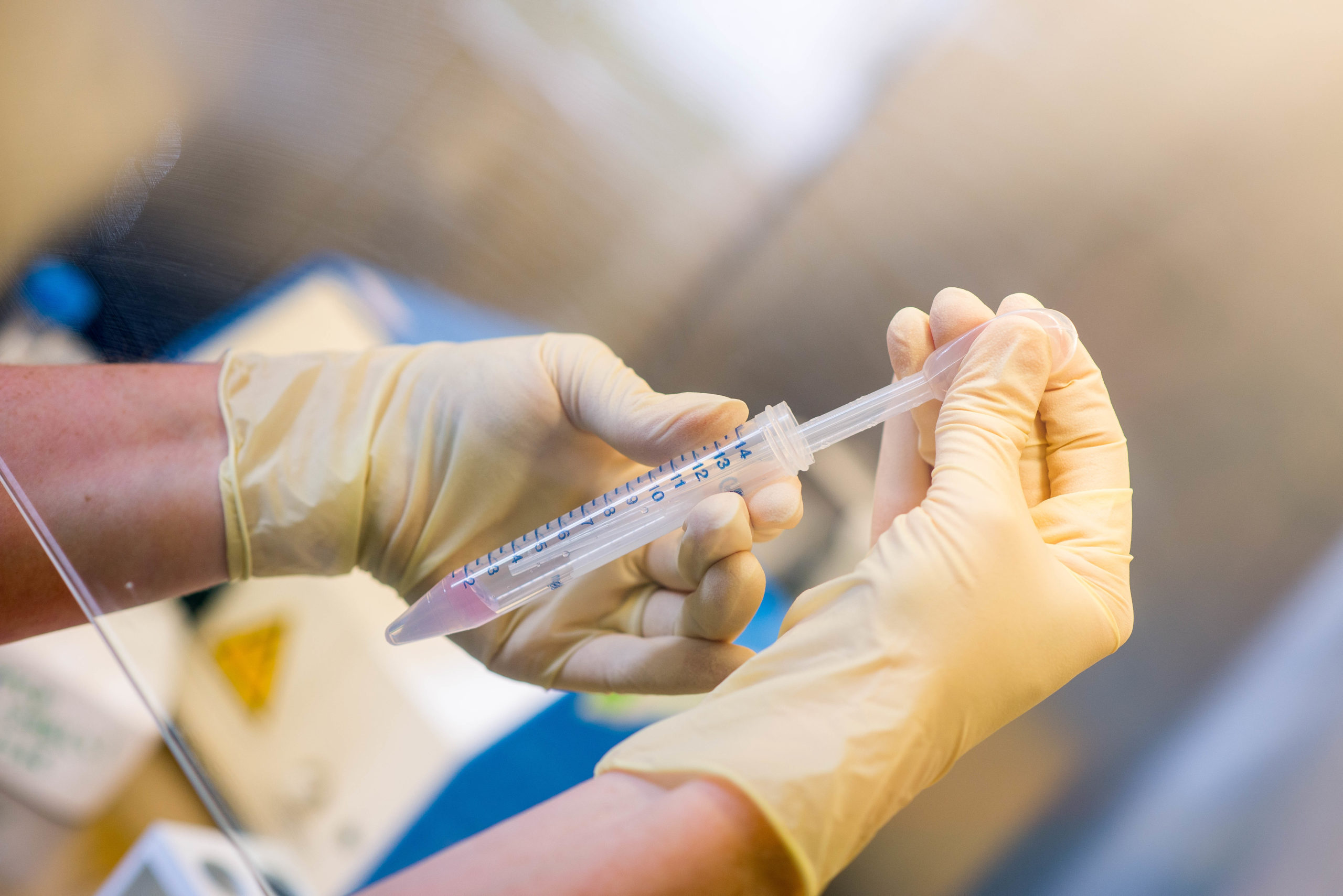 Intrauterine Insemination (IUI) - NUH Life